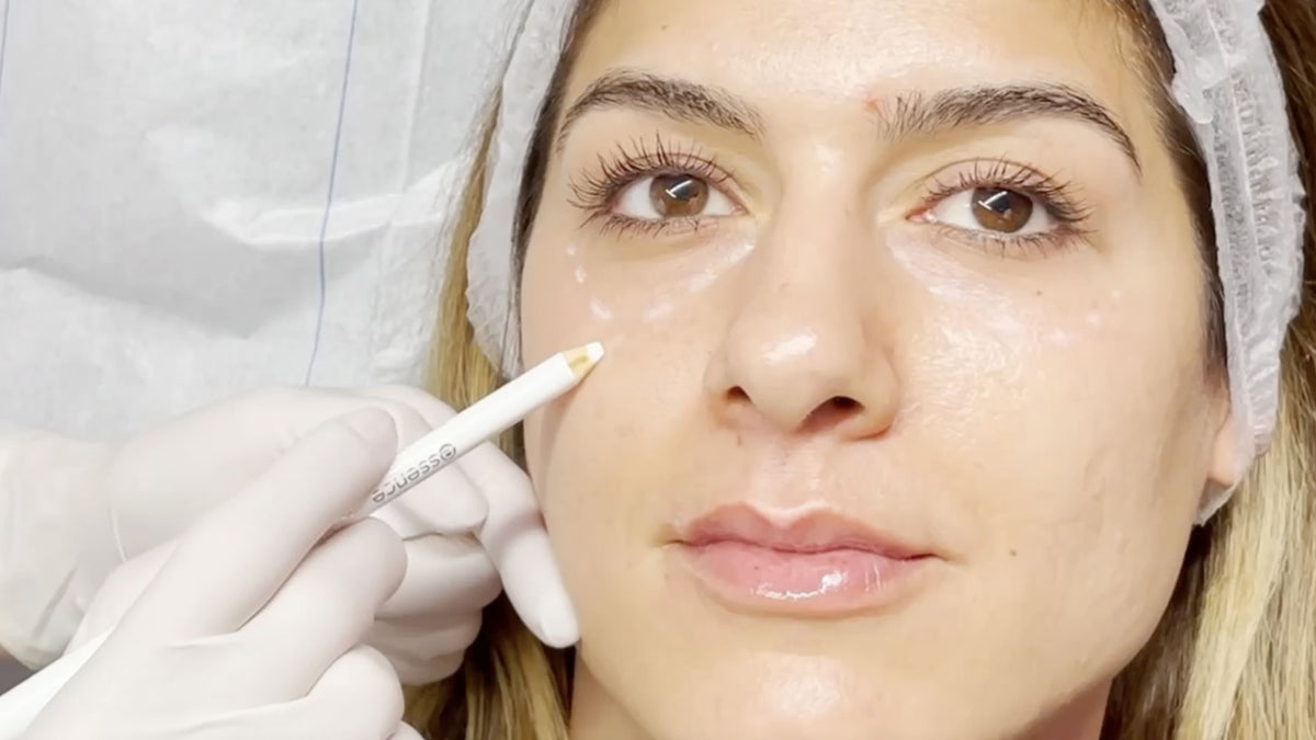 Revolutionäre Behandlung gegen Augenringe | docboom